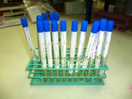 Streptococcus Test – What Is the Need?