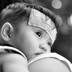 Childhood Stomatitis – What It Is and How to Treat It