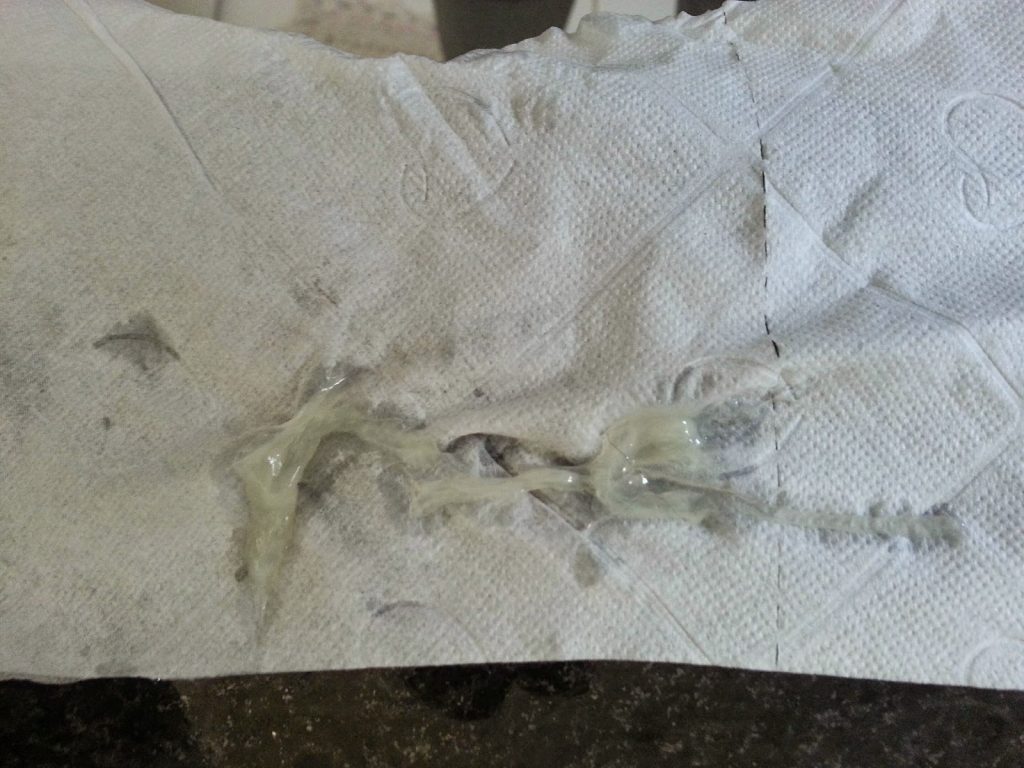 Mucus Plug: What It Is – And How to Identify It