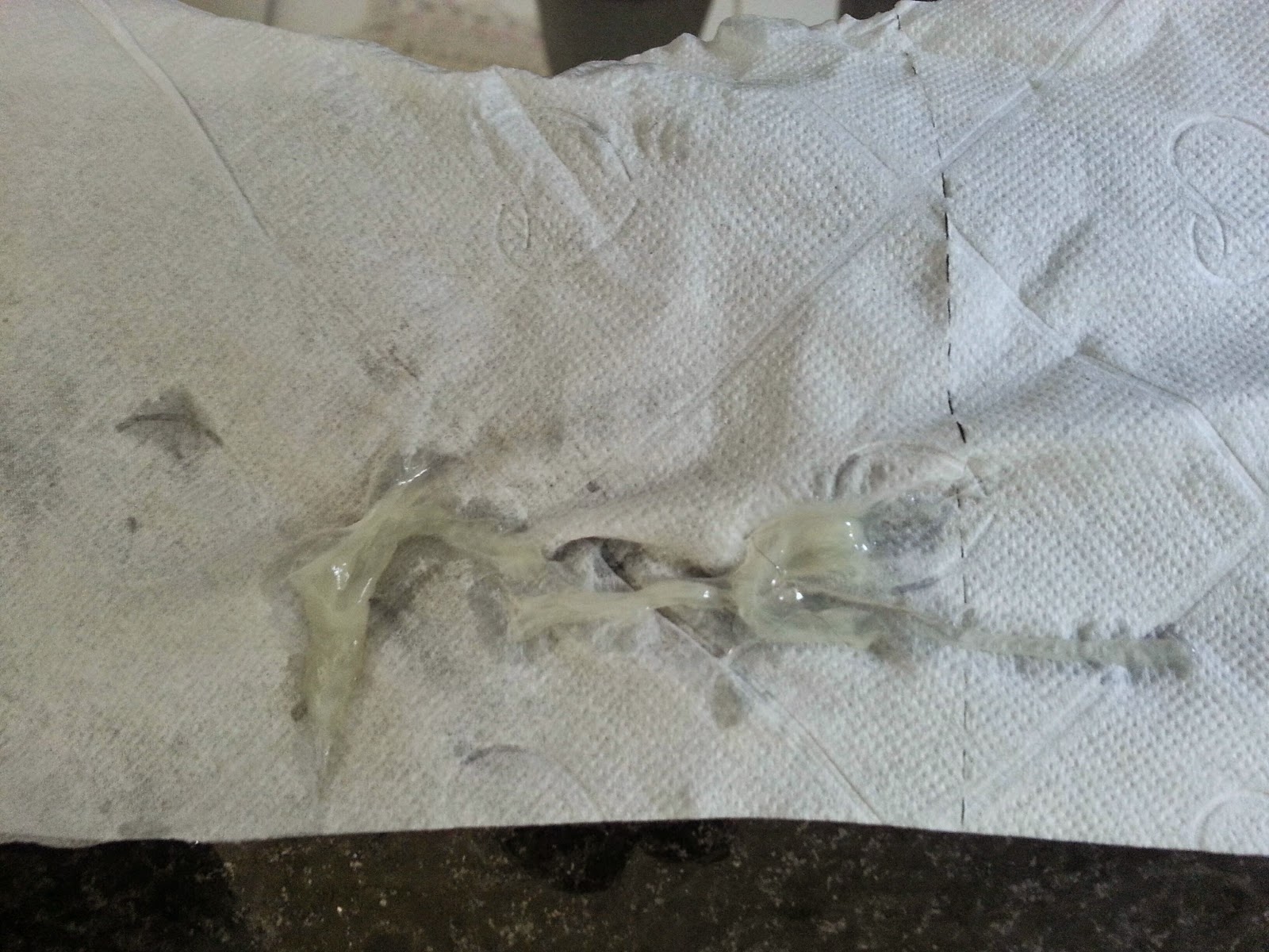 Mucus Plug: What It Is – And How to Identify It